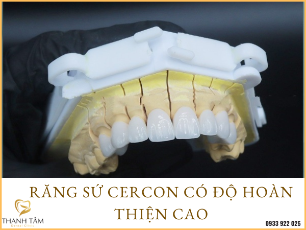 Răng Sứ Cercon Có Tốt Không? 4 Đặc Điểm Chính