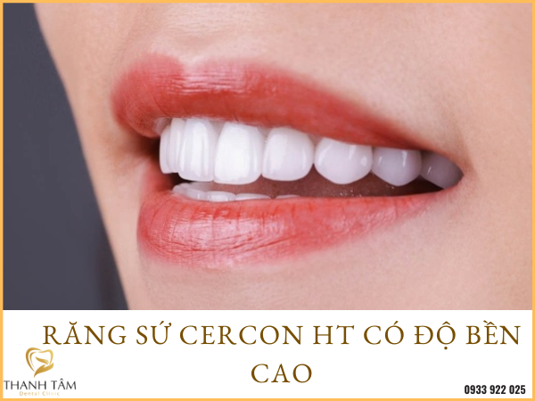 Răng Sứ Cercon HT Giá Bao Nhiêu? 3 Ưu Điểm Nổi Bật